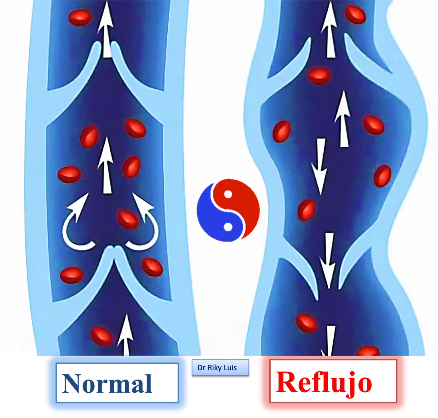 ☝️👨‍⚕️Venas Normales y sanas🔵 - Clinica Vena Sana